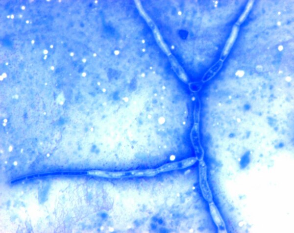 Methylene blue (C.I. 52015) CAS 7220-79-3 | 104122